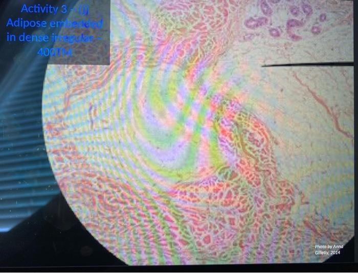 Solved Activity 3 Adipose embele in dense jedan 400708 Photo | Chegg.com