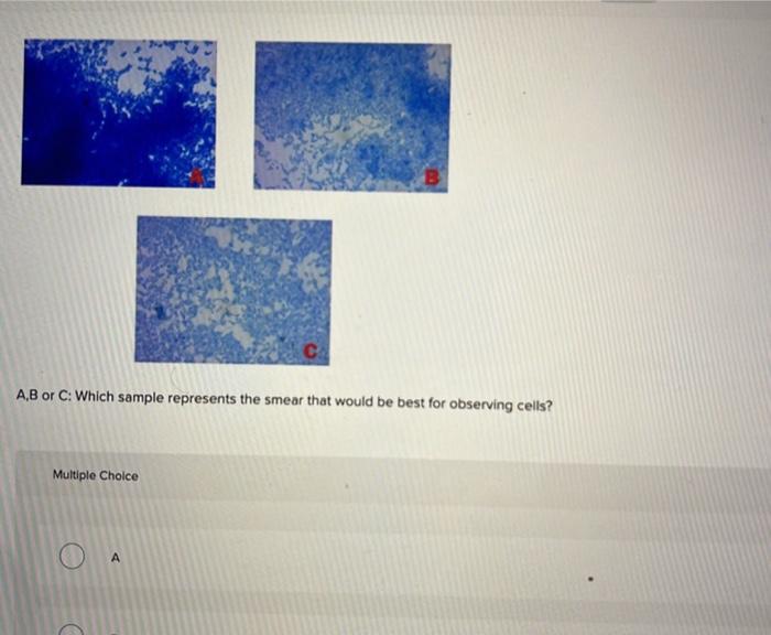 Solved A,B or C: Which sample represents the smear that | Chegg.com