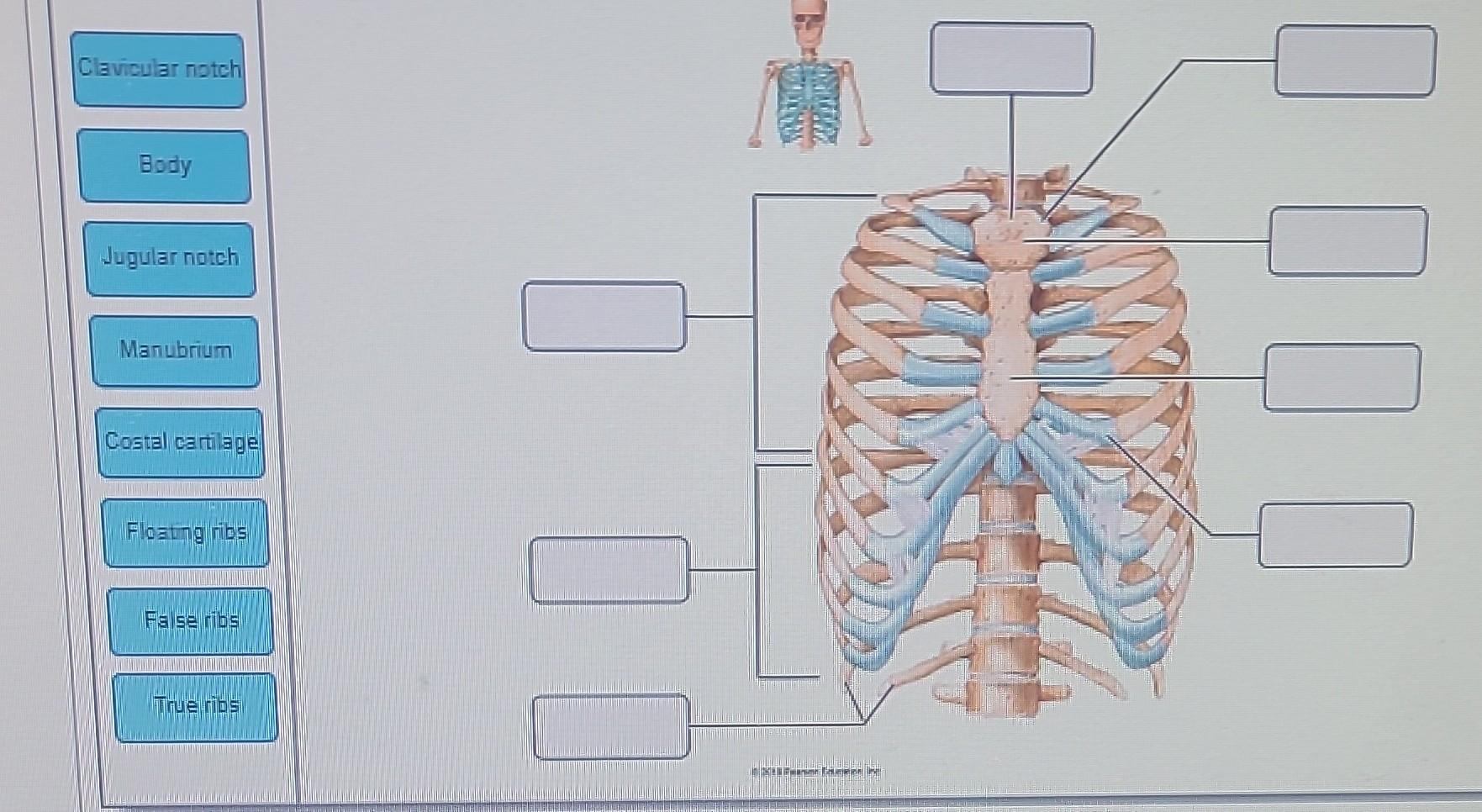Solved Clavicular notch Jugular notch Manubrium Costal | Chegg.com