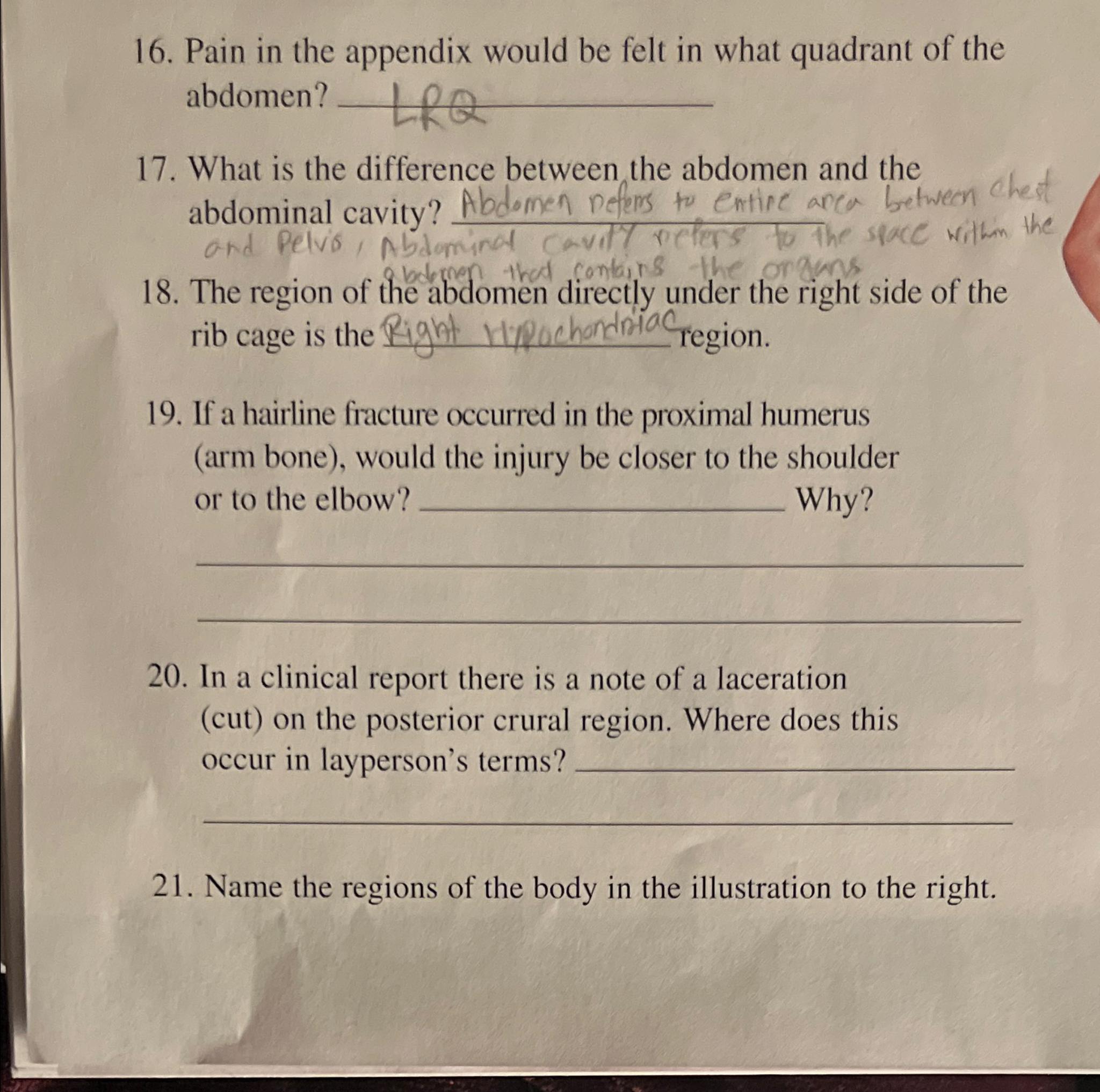 Solved Pain in the appendix would be felt in what quadrant | Chegg.com