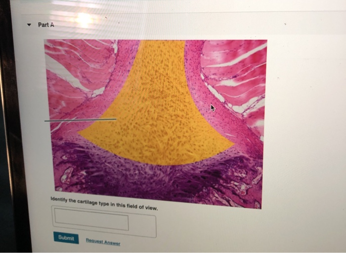 Solved Part A Identify the cartilage type in this field of | Chegg.com