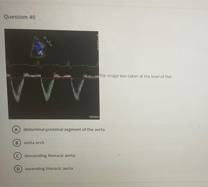 Solved Question 41 Abnormal rocking motion of a prosthetic | Chegg.com