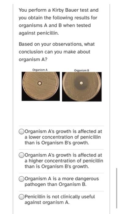 Solved You perform a Kirby Bauer test and you obtain the | Chegg.com