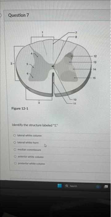 Solved Identify the structure labeled "1." lateral white | Chegg.com