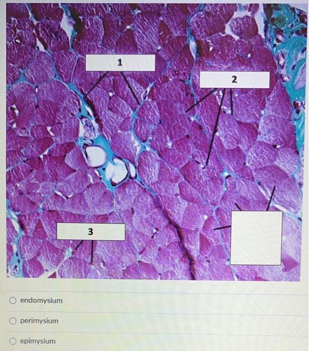 Solved 1 2 3 endomysium perimysium epimysium | Chegg.com
