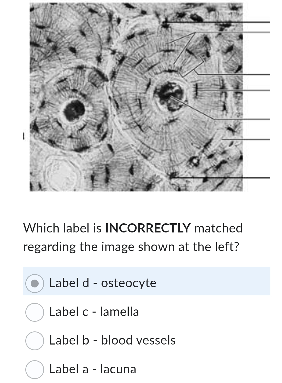 Solved Which label is INCORRECTLY matched regarding the | Chegg.com
