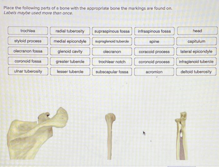 Solved Fill in the sentences describing the parts of the | Chegg.com