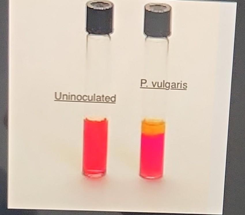 Solved Protein II - Data Uninoculated P. vulgaris P. | Chegg.com