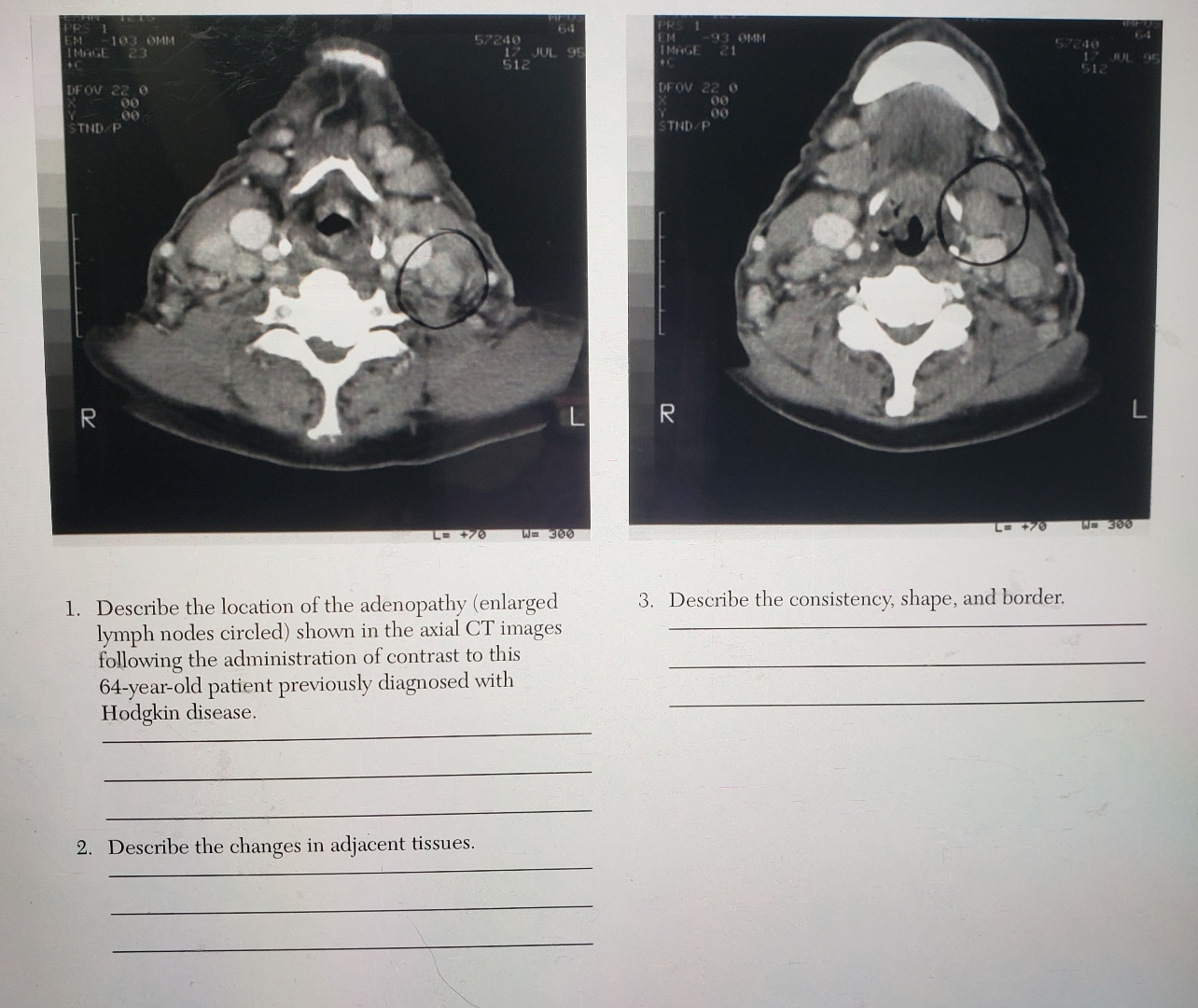 Solved Describe the location of the adenopathy (enlarged | Chegg.com