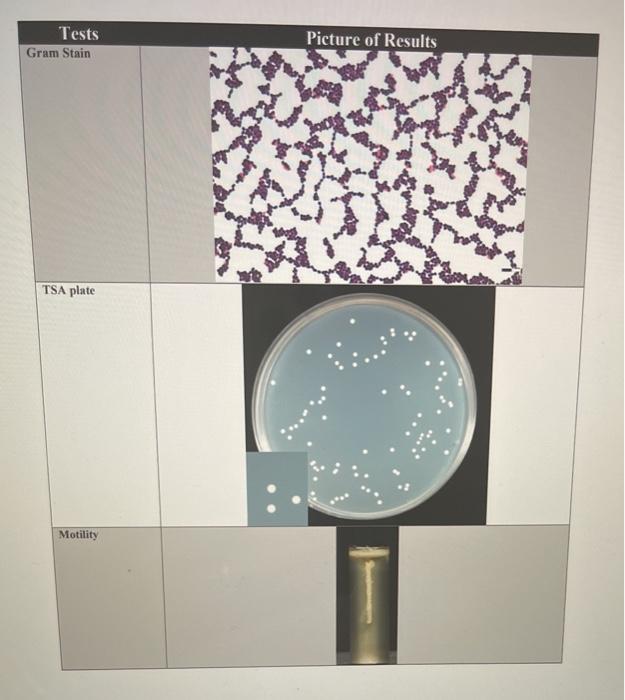 Solved Part 2: Media and Biochemical Tests For Gram Positive | Chegg.com