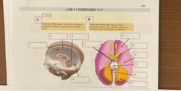 Solved LAB 11 EXERCISES 11-7 188 CNS A B Label the | Chegg.com