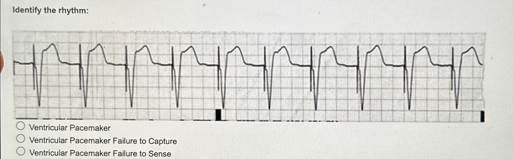 Solved Identify the rhythm:Ventricular PacemakerVentricular | Chegg.com