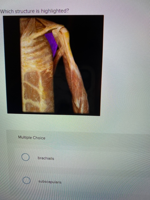 Solved Which structure is highlighted? Multiple Choice О O | Chegg.com