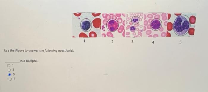 Solved 1 2 3 4 5 Use the Figure to answer the following | Chegg.com