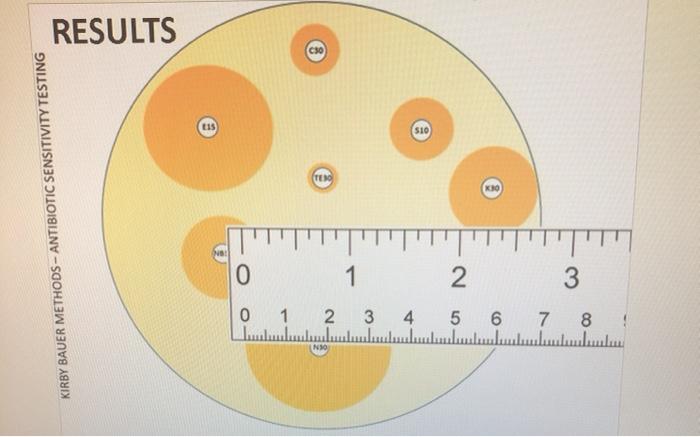 Solved Results: Table 1. Zone Size Interpretation Chart and | Chegg.com