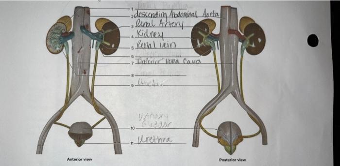 Solved label the major organs in associated major blood | Chegg.com