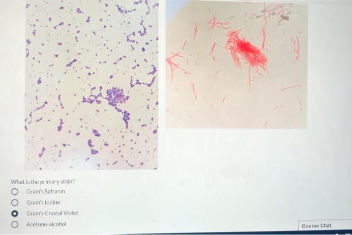 Solved What is the primary stain? Gram's Safranin Gram's | Chegg.com