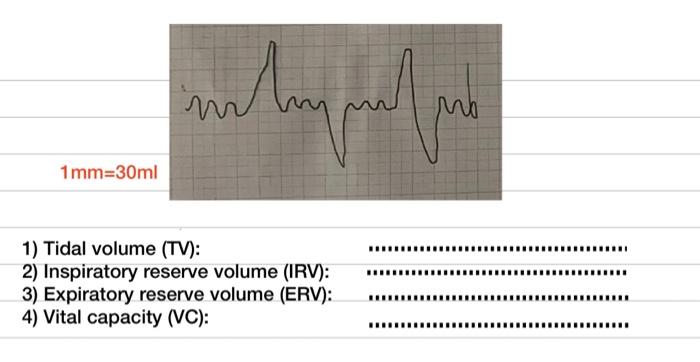 Solved 1) Tidal volume (TV): 2) Inspiratory reserve volume | Chegg.com