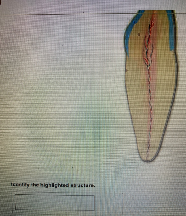 Solved Identify the highlighted structure. | Chegg.com