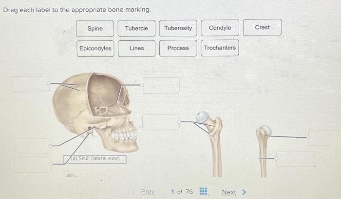 Solved Drag each label to the appropriate bone marking. | Chegg.com
