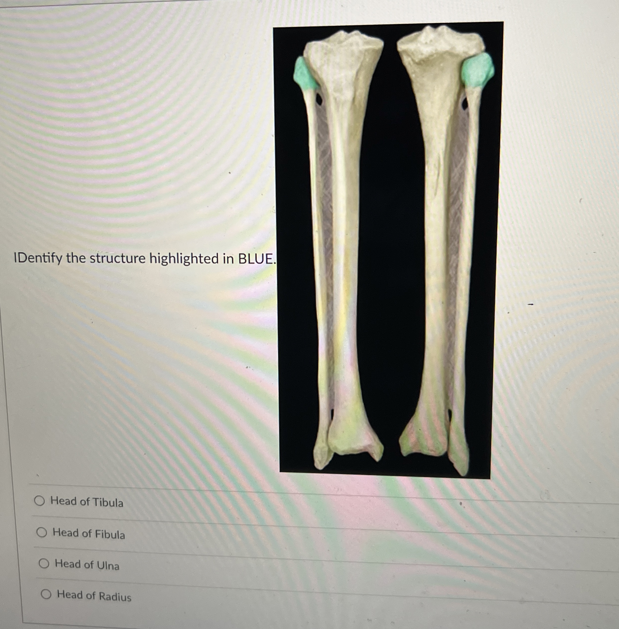Solved IDentify the structure highlighted in BLUE.Head of | Chegg.com