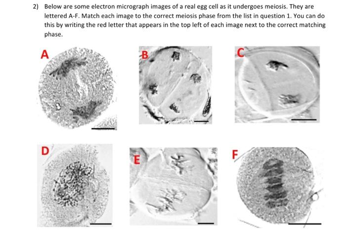 Solved Below are some electron micrograph images of a real | Chegg.com