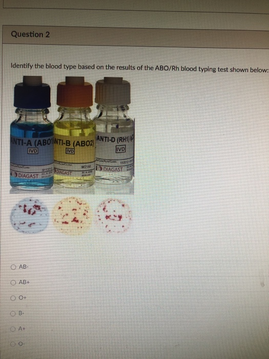 Solved identify the blood type based on the results of the | Chegg.com
