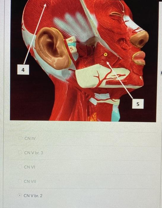 Solved 4 4 5 5 CNV CNV br. 3 CNV CN VII CN V br. 2 | Chegg.com