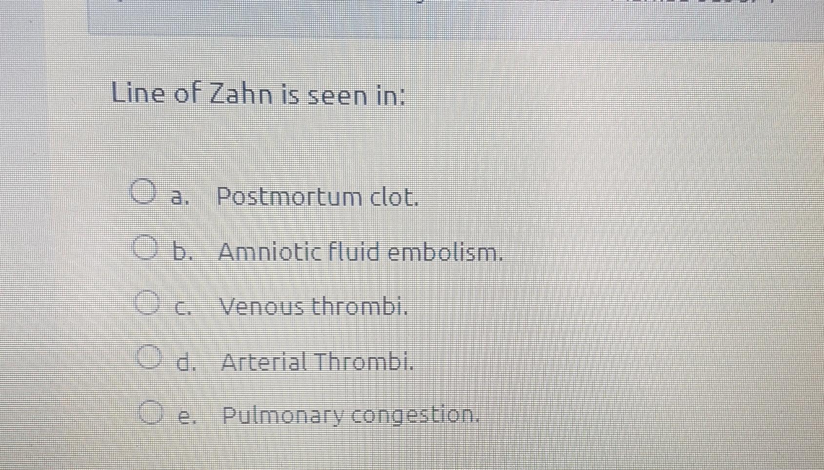 Solved Line of Zahn is seen in:a. ﻿Postmortum clot.b. | Chegg.com