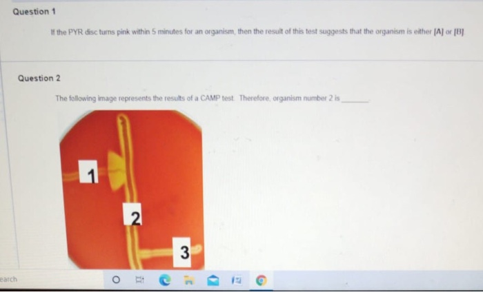 Solved Question 1 If the PYR disc turns pink within 5 | Chegg.com