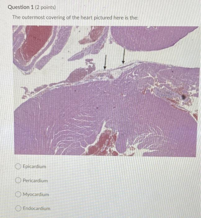 Solved Question 1 (2 points) The outermost covering of the | Chegg.com