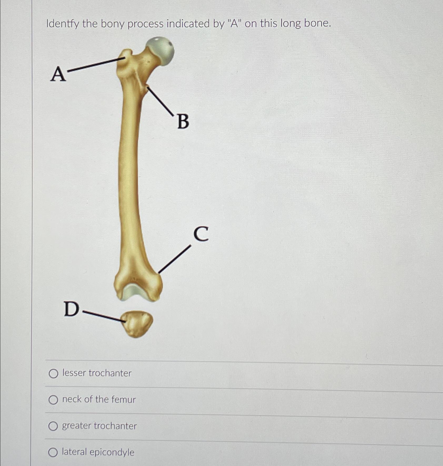 Solved Identfy the bony process indicated by " A " ﻿on this | Chegg.com