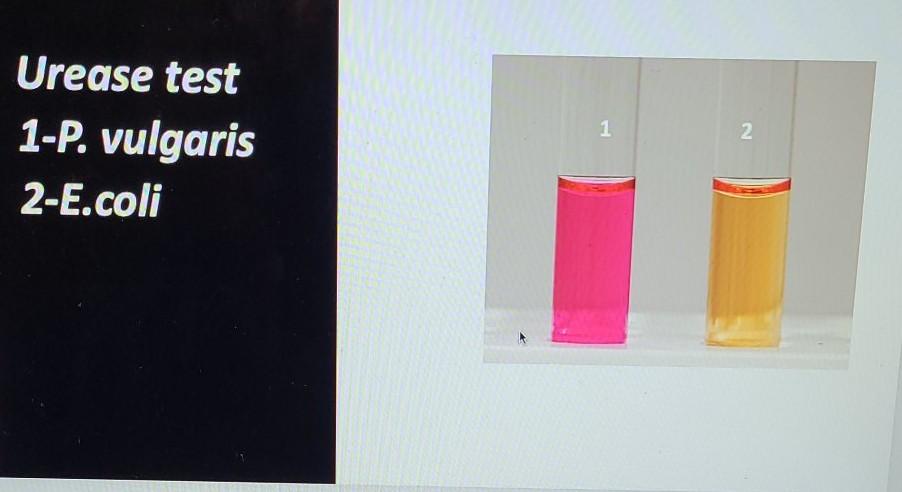 Solved Starch Agar-Looking at the results presentation | Chegg.com