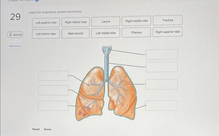 Solved Label the structures of the lower respiratory tract. | Chegg.com