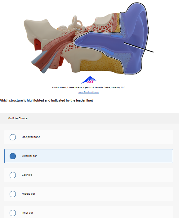 Solved E10 ﻿Ear Madel, 3 ﻿timex life size, 4 ﻿part C 3 ﻿B | Chegg.com