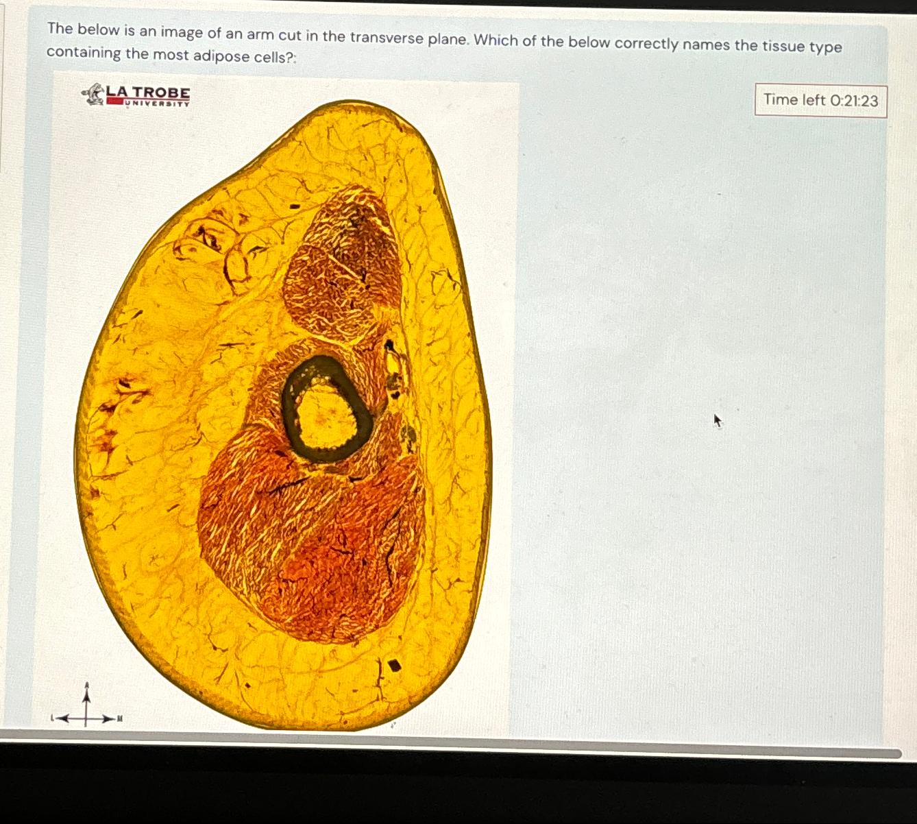 Solved The below is an image of an arm cut in the transverse | Chegg.com
