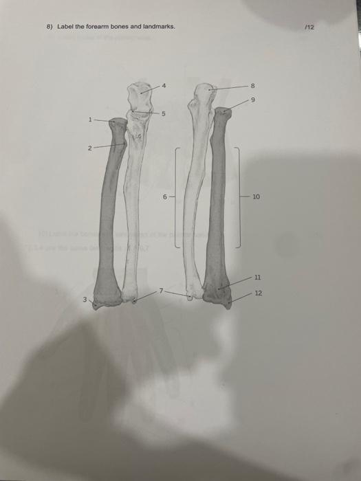 Solved 8) Label the forearm bones and landmarks. | Chegg.com
