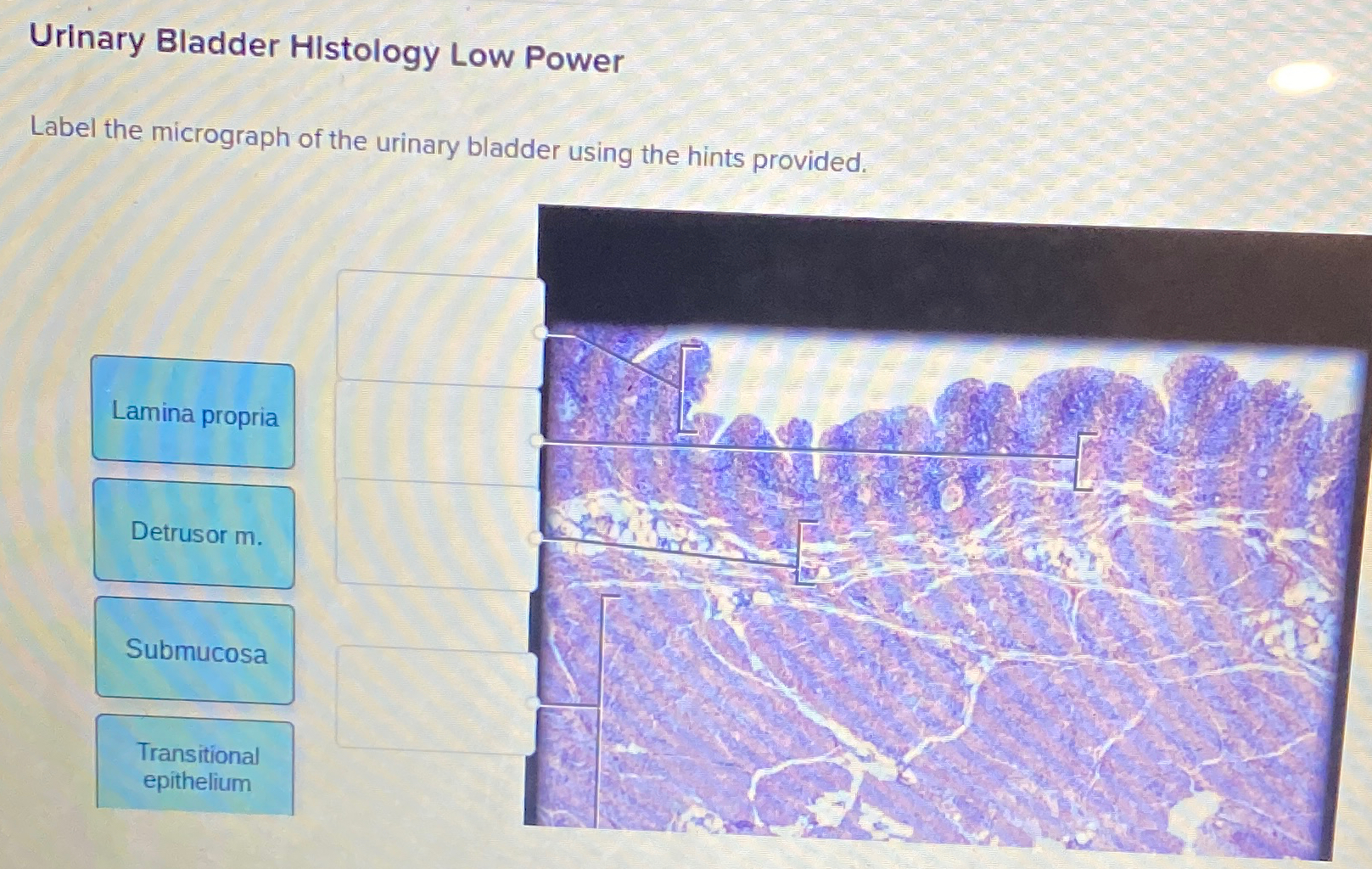 Solved Urinary Bladder Histology Low PowerLabel the | Chegg.com