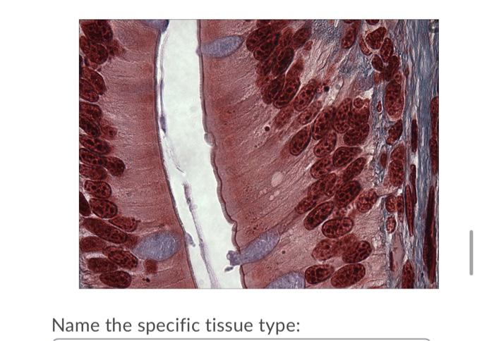 + 1. General tissue type: EPITHELIAL Specific tissue | Chegg.com