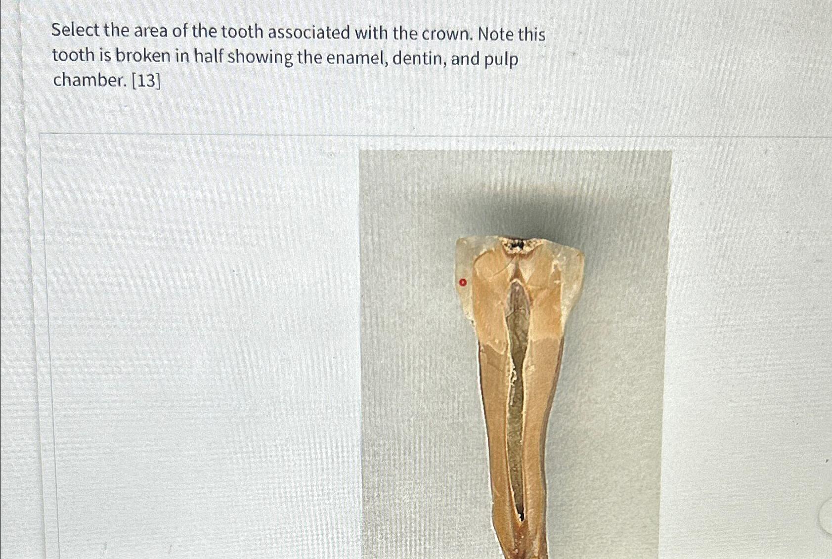 Solved Select the area of the tooth associated with the | Chegg.com