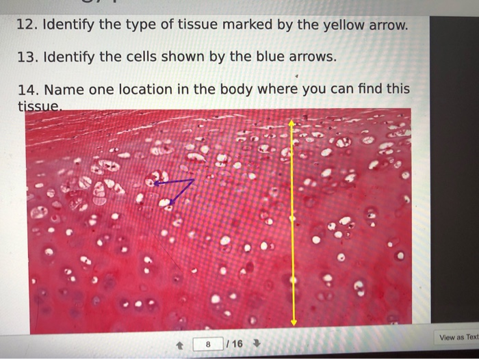 Solved 12. Identify the type of tissue marked by the yellow | Chegg.com