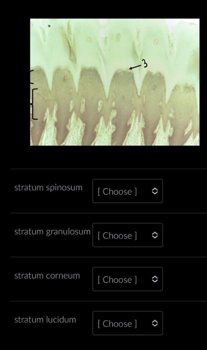 Solved stratum spinosum stratum granulosum stratum corneum | Chegg.com