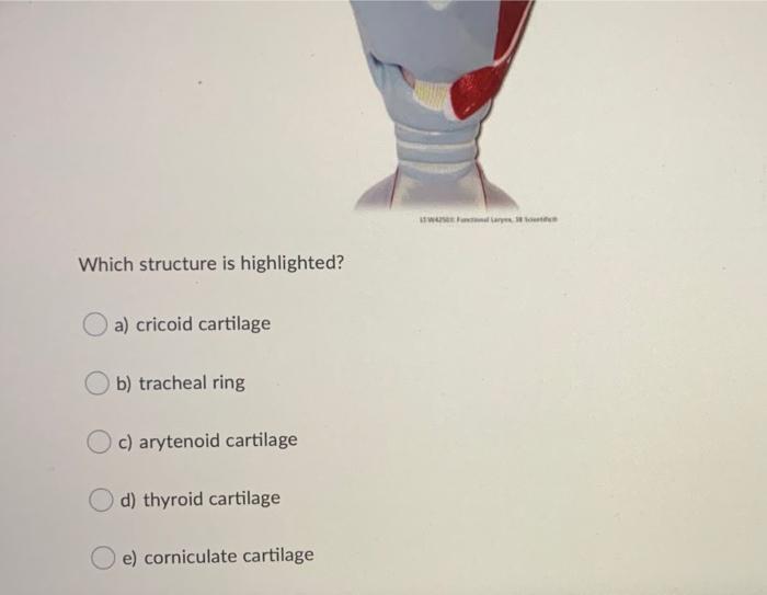 Solved www.ca Which structure is highlighted? a) cricoid | Chegg.com