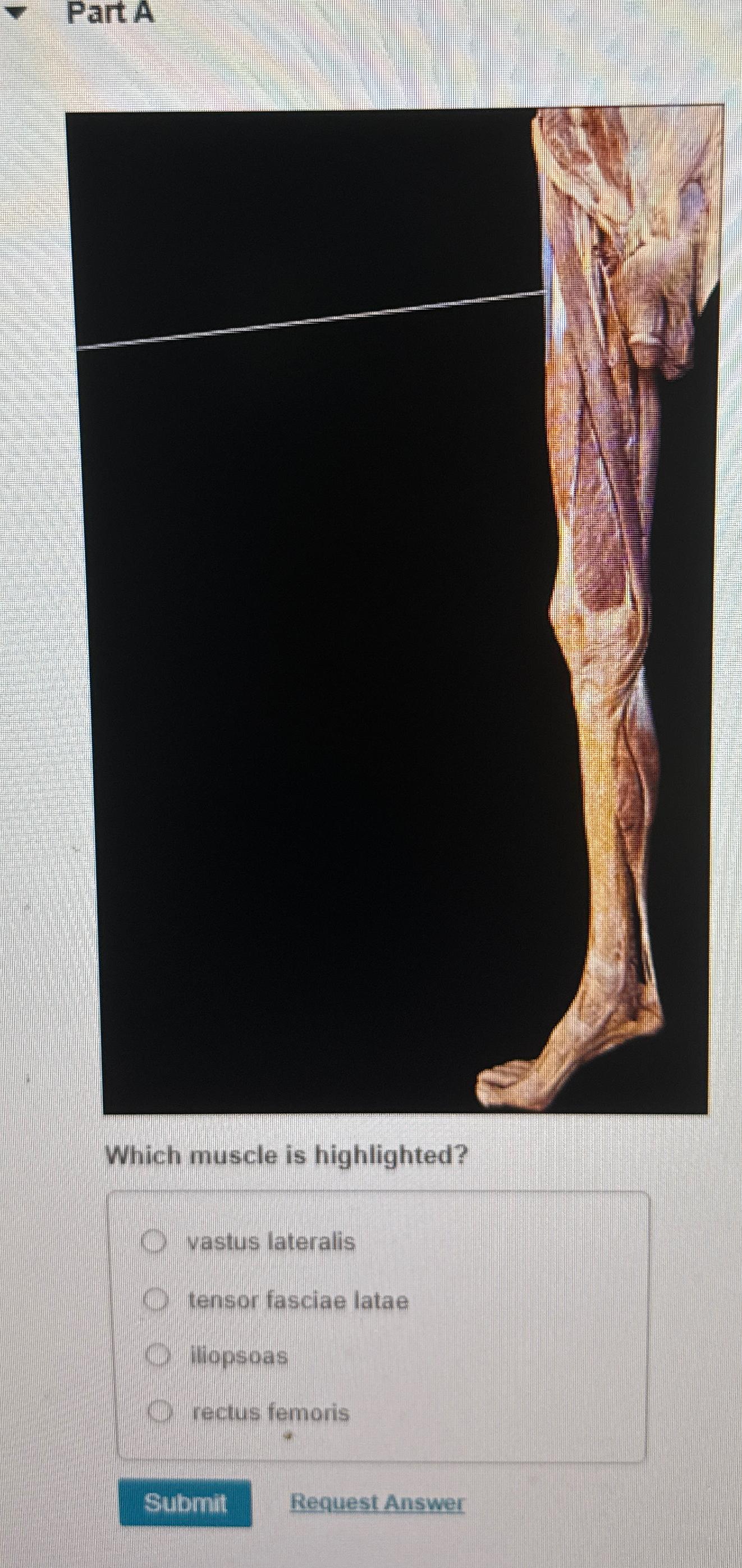 Solved Part AWhich muscle is highlighted?vastus | Chegg.com
