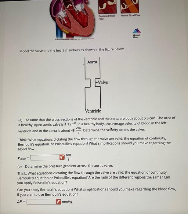 Solved Homework: Bernoulli's Equation - Unhealthy Valve | Chegg.com