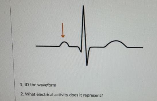 Solved 1. ID the waveform 2. What electrical activity does | Chegg.com