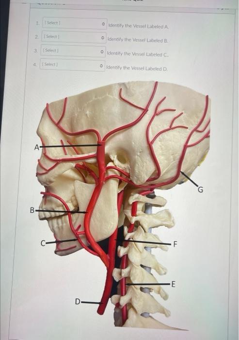 1. Identity the Vessel Labeled L 2. Identify the | Chegg.com