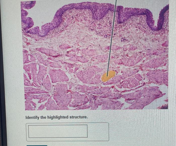 Identity the highlighted structures. Identify the | Chegg.com