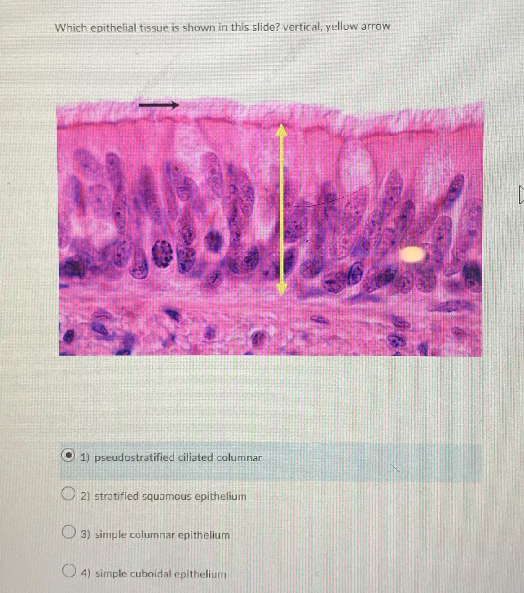Solved Which epithelial tissue is shown in this slide? | Chegg.com
