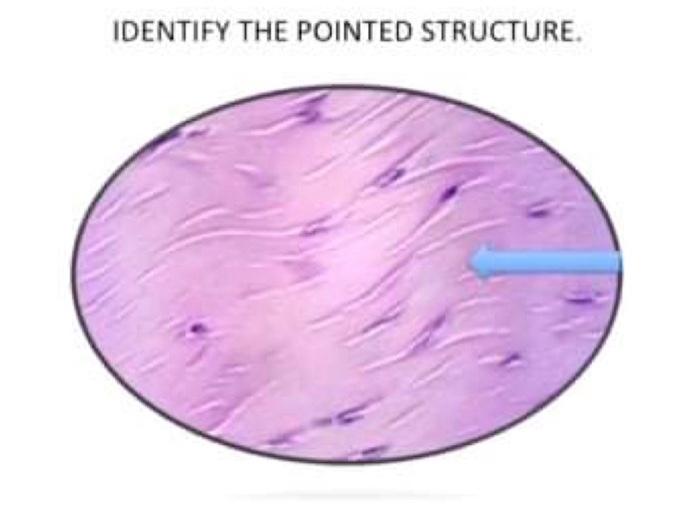 Solved IDENTIFY THE POINTED STRUCTURE. IDENTIFY THE | Chegg.com Solved IDENTIFY THE POINTED STRUCTURE. IDENTIFY THE | Chegg.com